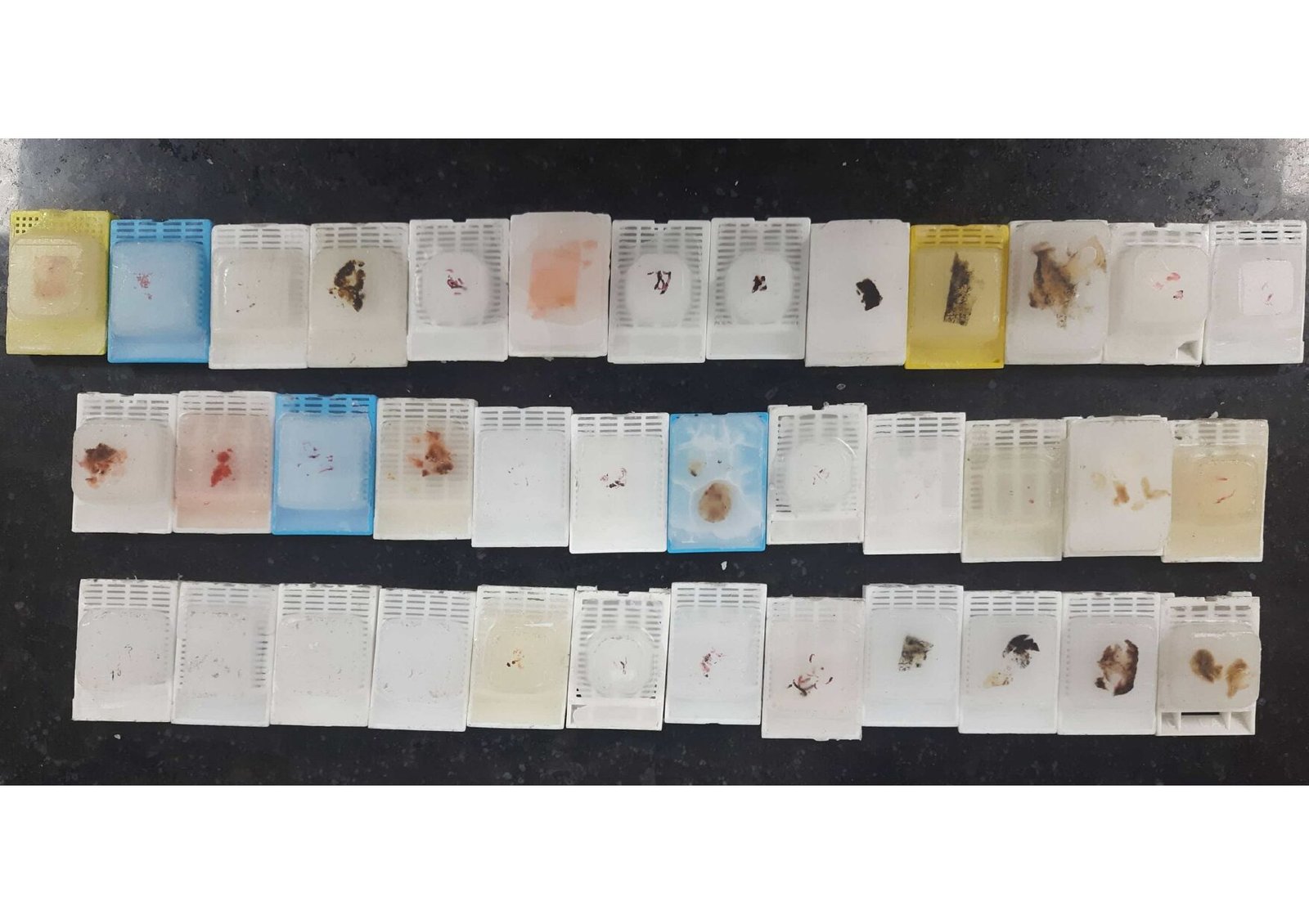 FFPE Blocks Lung Cancer